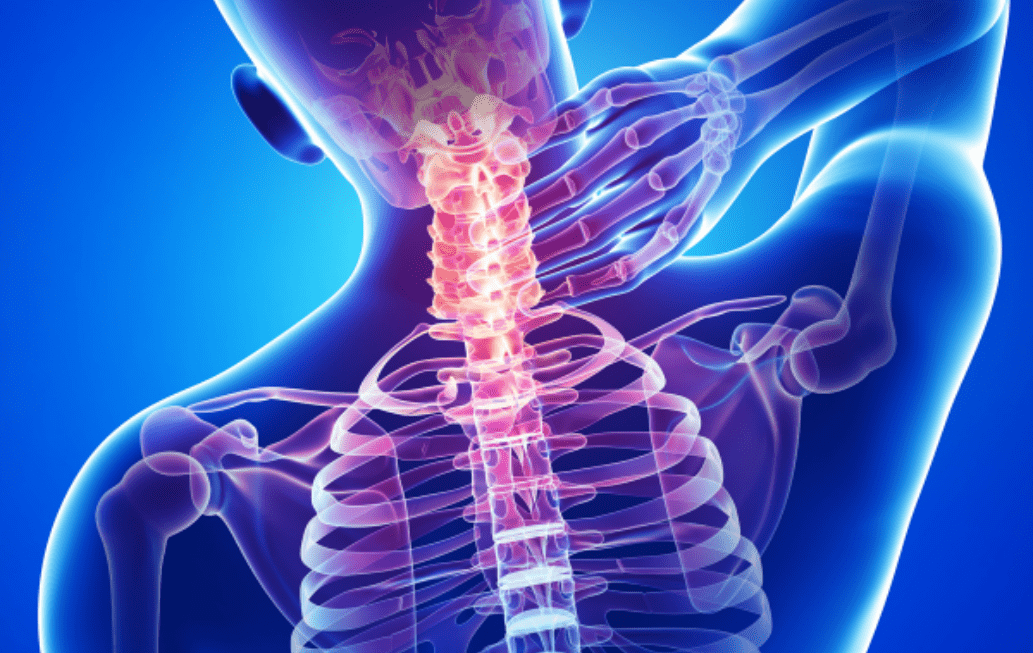 Cervical pain: what it is and how to treat it - I-Tech Medical Division